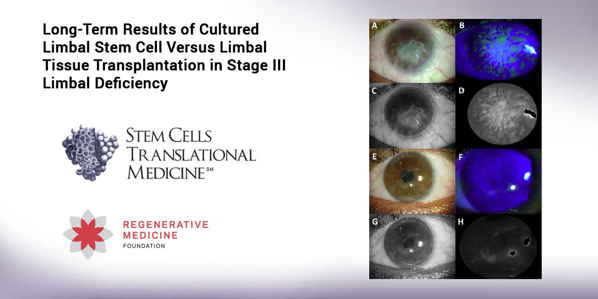 Study shows stem cells may be better choice than tissue transplantation ...